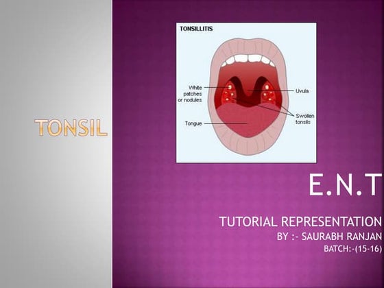 Anatomy and histology of the palatine tonsils.pptx