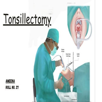 Tonsillectomy_20260206_100802_0000.pdf a ppt on tonsillectomy | PDF
