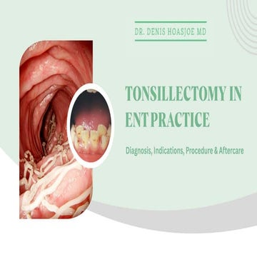 Tonsillectomy in ENT Practice - Denis K Hoasjoe MD | PDF