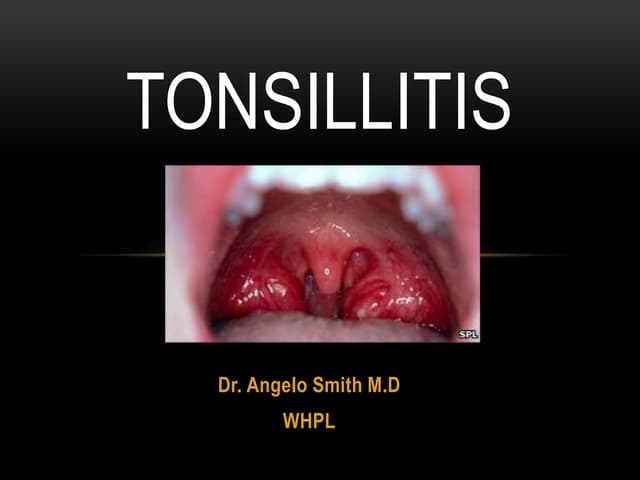 Nursing management of the patient with Tonsillitis PPT | PPTX