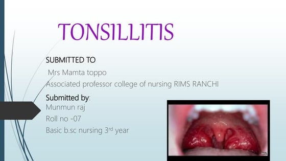 Nursing management of the patient with Tonsillitis PPT | PPTX