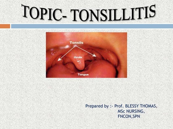Anatomy and physiology tonsils | PPTX | Ear, Nose and Throat Conditions ...