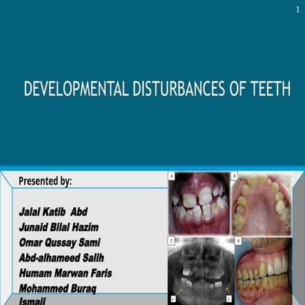 Tooth development disturbances 2.pp. tx | PPT