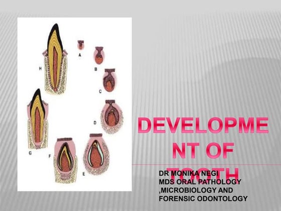 Stages of tooth development | PPT