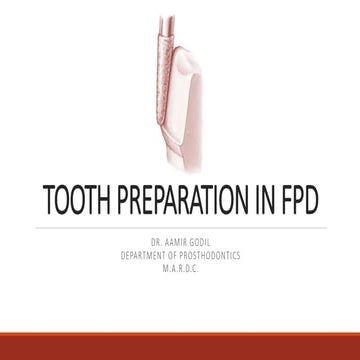 TOOTH PREPARATION: FULL VENEER CAST METAL CROWN | PPTX