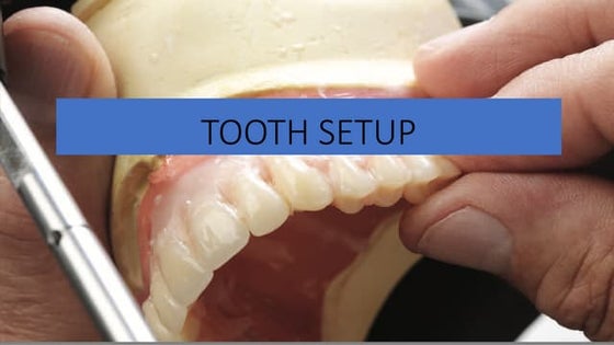 ABUTMENT TOOTH PREPARATION in removable partial denture.pptx | Dental Health | Diseases and ...