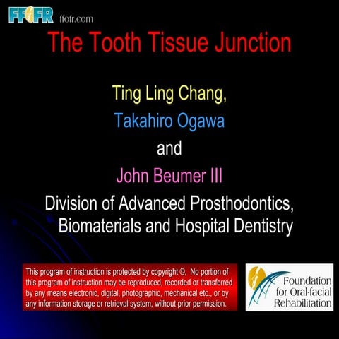 Tooth tissue junction, major and minor connectors | PPT