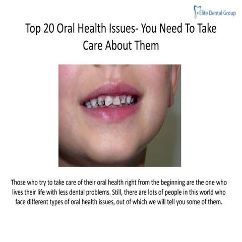 TOP 20 ORAL HEALTH ISSUES- YOU NEED TO TAKE CARE ABOUT THEM | PPTX