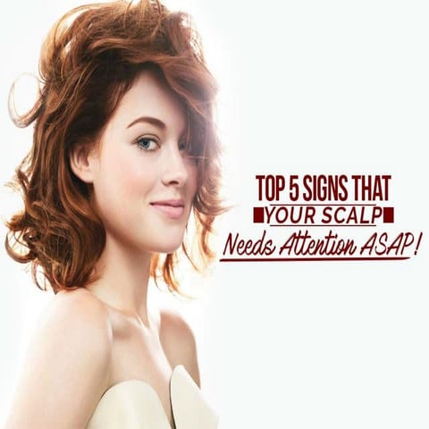 Top 5 Signs That Your Scalp Needs Attention Asap Ppt