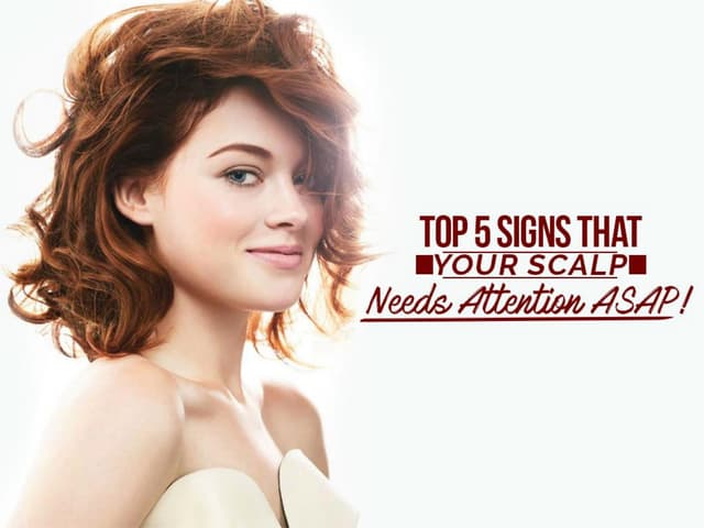 Top 5 Signs That Your Scalp Needs Attention Asap Ppt