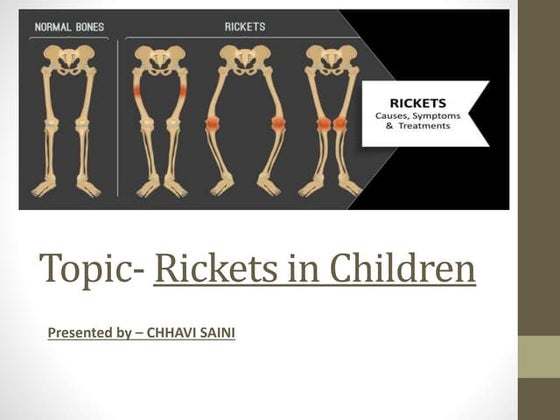 Human skeleton | PPT