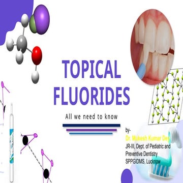 Topical Fluorides as Preventive Aid of Dental Caries in Children | PPTX