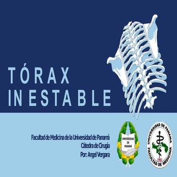 Tórax Inestable | PDF