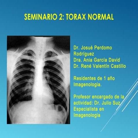rayos x, torax normal | PPT