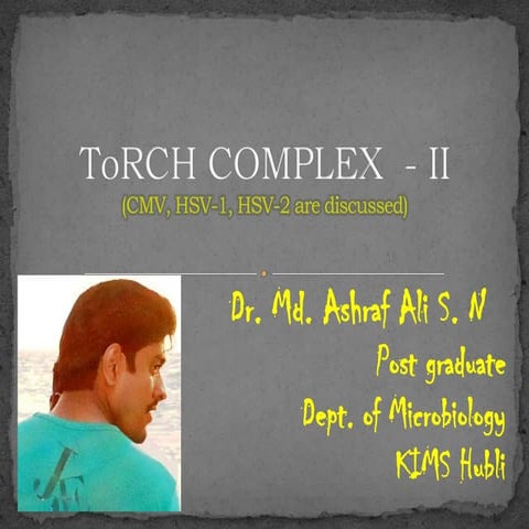 Lab diagnosis of ToRCH complex | PPSX
