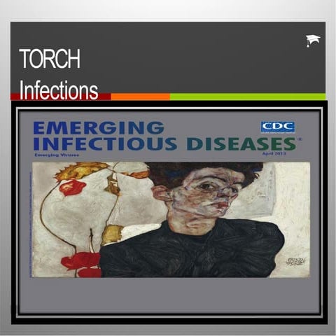 TORCH IN INFECTION ppt for the Nursing Students | PPTX