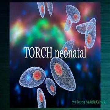 Sindrome TORCH neonatal y sus complicaciones | PPTX