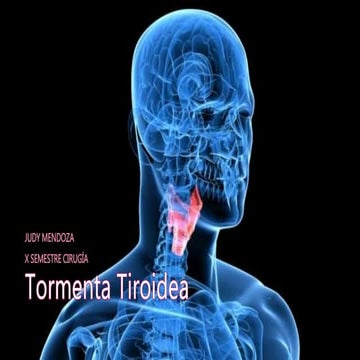 Tormenta tiroidea | PPTX