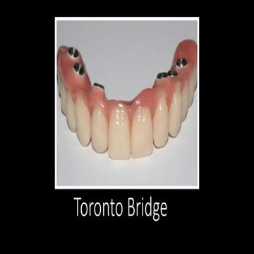 Toronto Bridge | PPTX