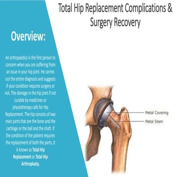 Total Hip Replacement Complications & Surgery Recovery | PPTX