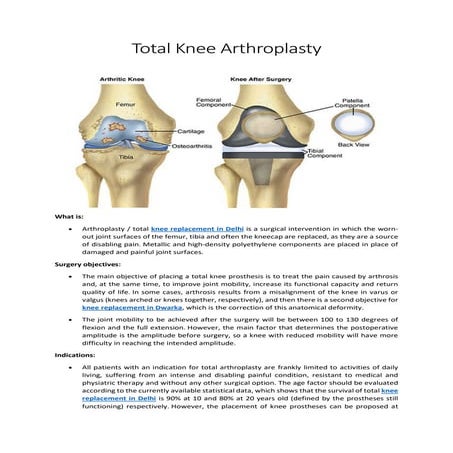 Total Knee Arthroplasty | PDF | Physical Therapy | Wellness