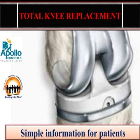 Total knee replacement patient education | PPTX