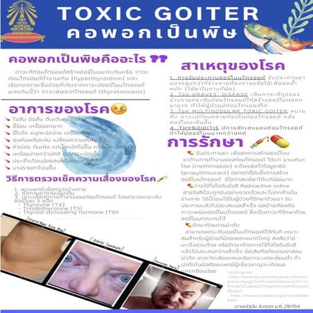 Toxic goiter | PDF