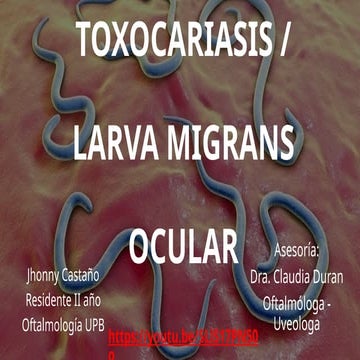 Toxocariasis ocular (Larva migrans, Toxocara canis y cati, helmintos ...