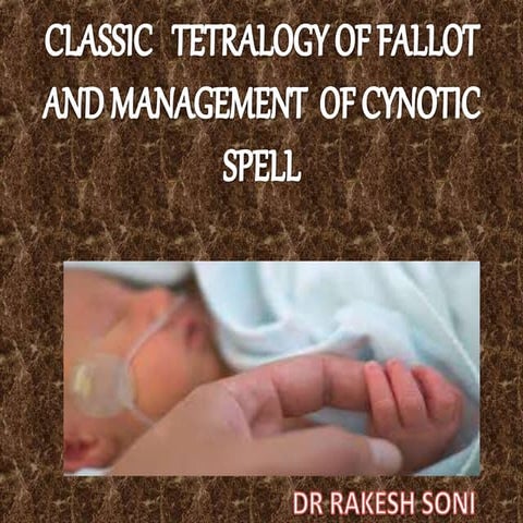 TETRALOGY OF FALLOT AND TET SPELL presentation | PPTX