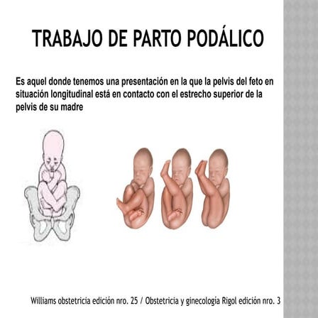 Parto podalico | PPTX