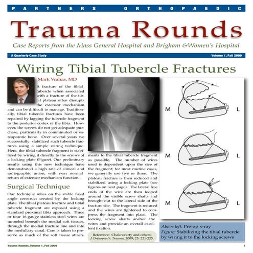 Wiring Tibial Tubercle Fractures | PDF