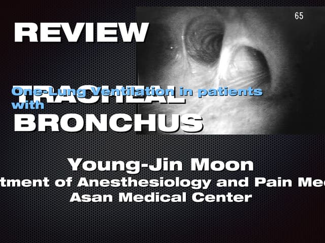 Video & fibreoptic laryngoscope | PPTX