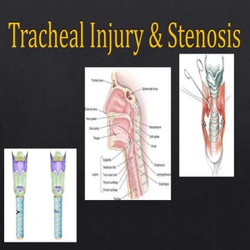 Tracheal injury & stenosis | PPTX