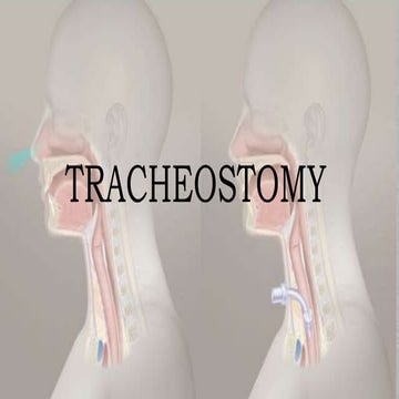 "Tracheostomy" Seminar for oral and maxillofacial surgery postgraduates ...