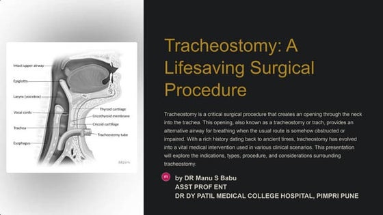 Tracheostomy).pptx. For bsc nursing students | PPTX