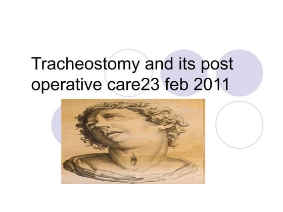 Tracheostomy care and management | PPTX
