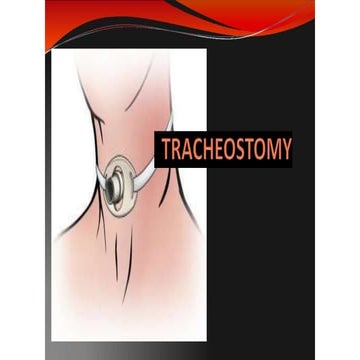 tracheostomy new.pptx by professor Dr Ahmed Al Abbasi | PPTX