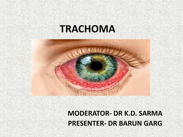 Ophthalmia Neonatorum or Neonatal Conjunctivitis | PPTX
