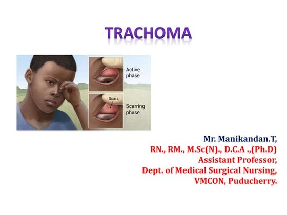 Eye irrigation | PPTX | Eye and Vision Conditions | Diseases and Conditions