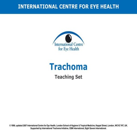 TRACHOMA.ppt