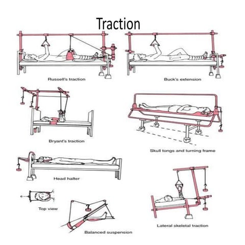 Traction | PPTX