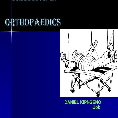 Application of traction in orthopaedics | PPT