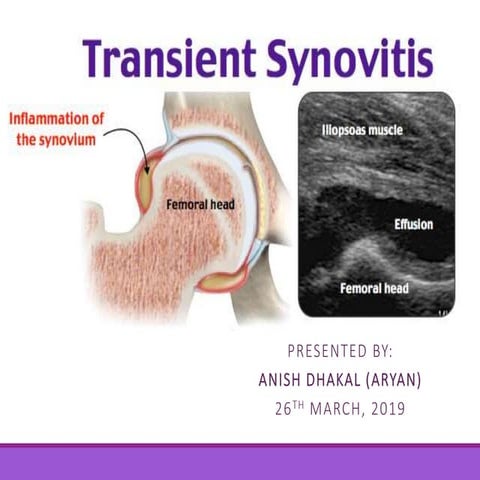 Transient Synovitis in Children | PPTX