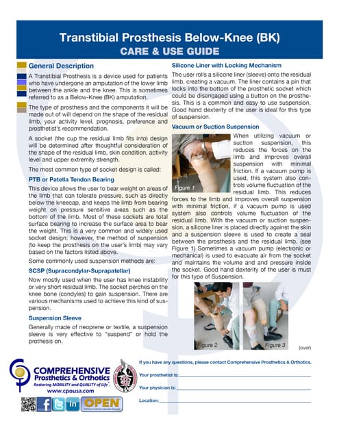 Transtibial Initial Alignment | PPT