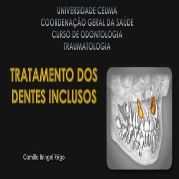 Arco Tipo I e Tipo II de Baume - Resumo Concurso Público de Odontologia.pdf