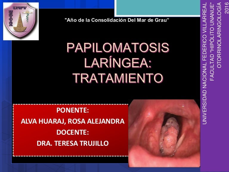 Tratamiento de papilomatosis laringea alva huaraj, rosa alejandra