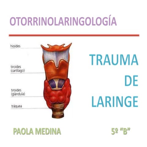 Trauma de laringe | PPTX