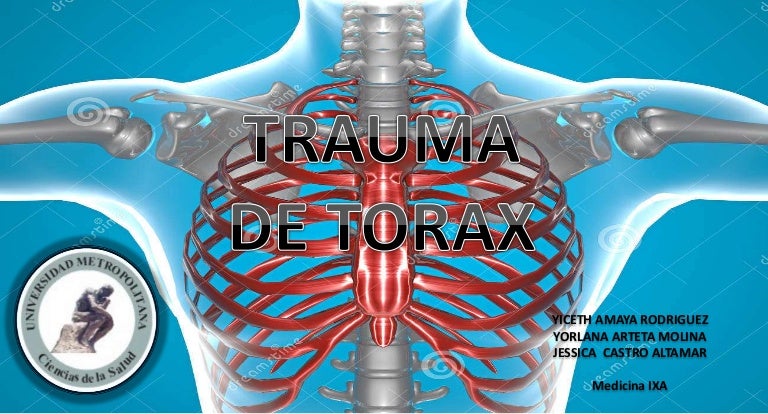 Trauma de torax