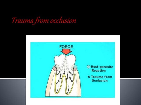 Trauma from occlusion | PPTX