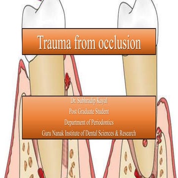 Trauma from occlusion in Periodontics.pptx